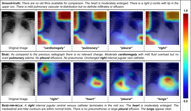 [2010.16056] Generating Radiology Reports via Memory-driven Transformer