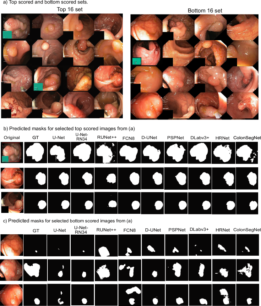 [2011.07631] Real-Time Polyp Detection, Localization and Segmentation in Colonoscopy Using Deep ...