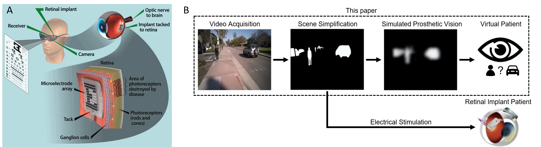 [2102.00297] Deep Learning–Based Scene Simplification for Bionic Vision
