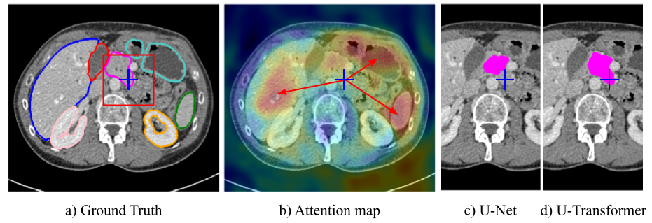 [2103.06104] U-Net Transformer: Self and Cross Attention for Medical Image Segmentation