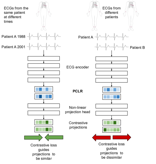 [2104.04569] Patient Contrastive Learning: a Performant, Expressive ...