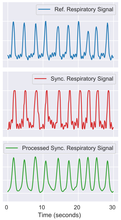 [2105.00594] An End-to-End and Accurate PPG-based Respiratory Rate Estimation Approach Using ...