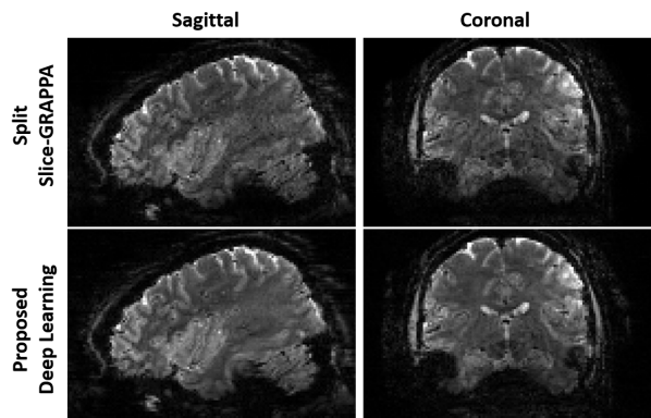 [2105.04532] Improved Simultaneous Multi-Slice Functional MRI Using Self-supervised Deep Learning