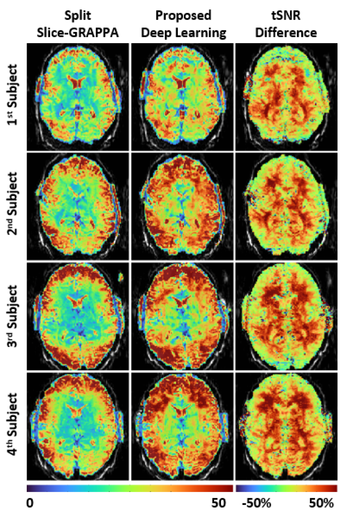 [2105.04532] Improved Simultaneous Multi-Slice Functional MRI Using Self-supervised Deep Learning
