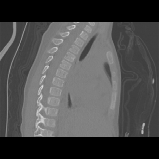 [2105.14711] CTSpine1K: A Large-Scale Dataset for Spinal Vertebrae ...