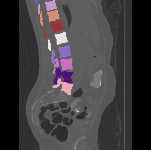 [2105.14711] CTSpine1K: A Large-Scale Dataset for Spinal Vertebrae ...
