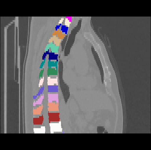 [2105.14711] CTSpine1K: A Large-Scale Dataset for Spinal Vertebrae ...