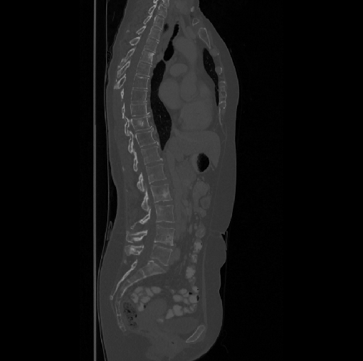 [2105.14711] CTSpine1K: A Large-Scale Dataset for Spinal Vertebrae ...