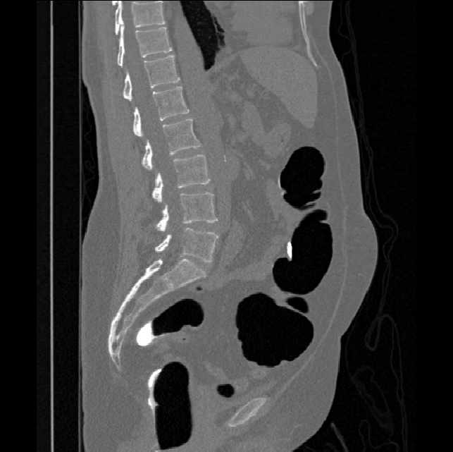 [2105.14711] CTSpine1K: A Large-Scale Dataset for Spinal Vertebrae ...