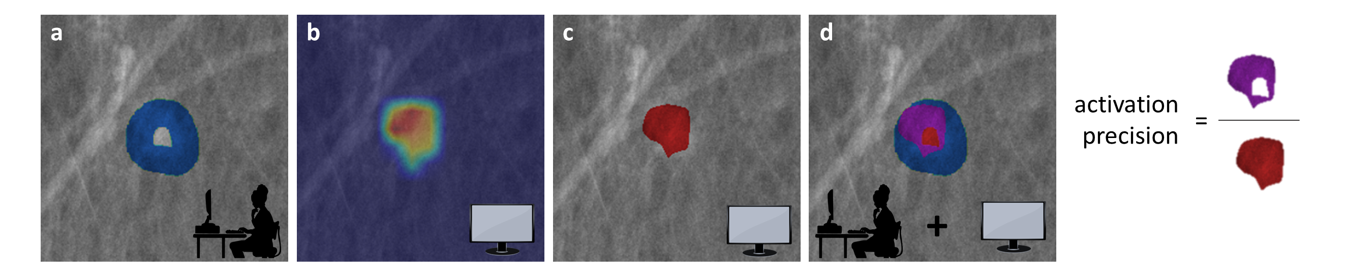 [2107.05605] Interpretable Mammographic Image Classification using Case-Based Reasoning and Deep ...