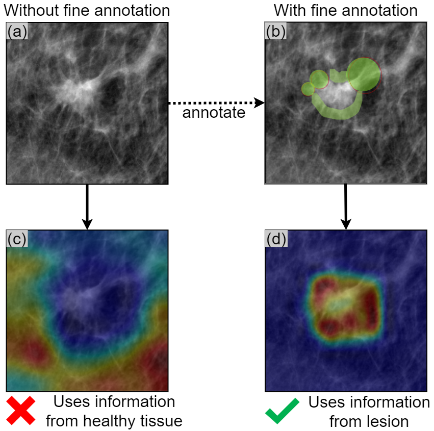 [2107.05605] Interpretable Mammographic Image Classification using Case-Based Reasoning and Deep ...