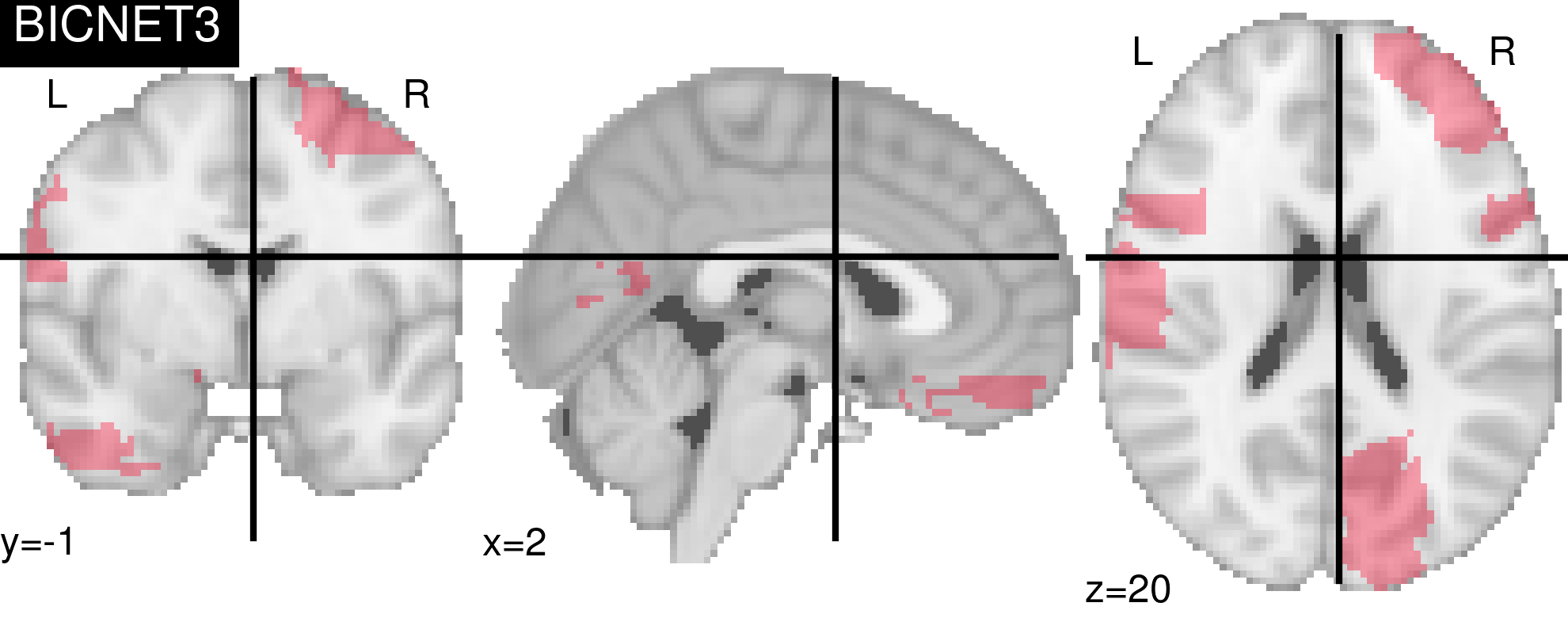 [2107.09160] BICNet: A Bayesian Approach for Estimating Task Effects on ...