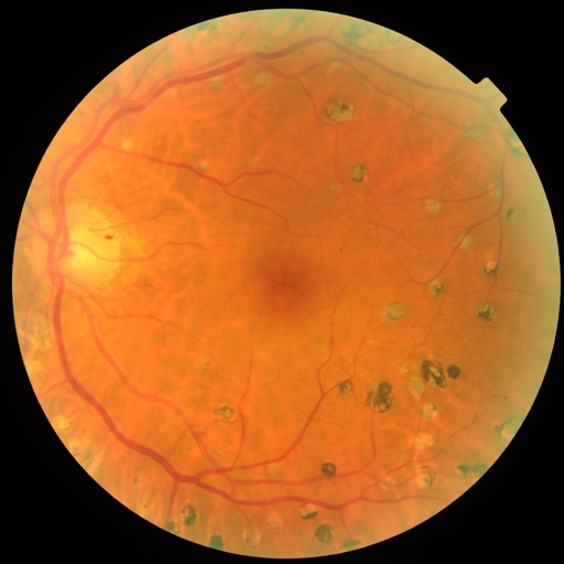 [2107.09372] Self-Supervised Domain Adaptation for Diabetic Retinopathy ...