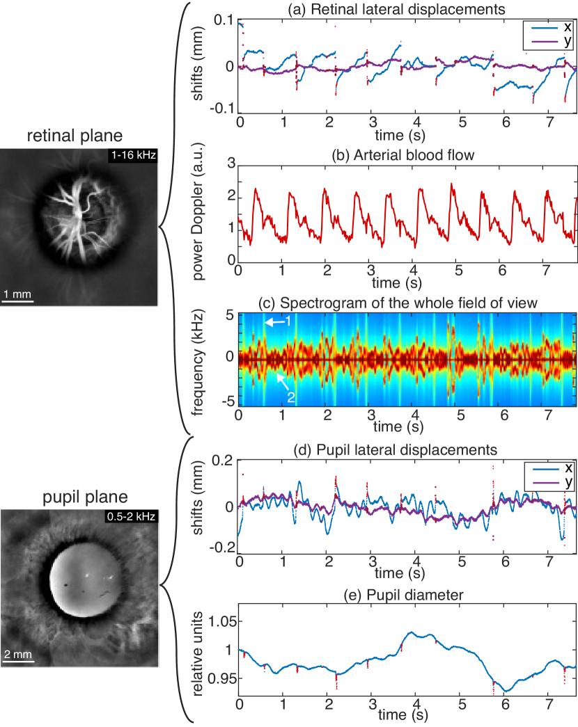 [2107.10799] Laser Doppler holography of the anterior segment for blood ...
