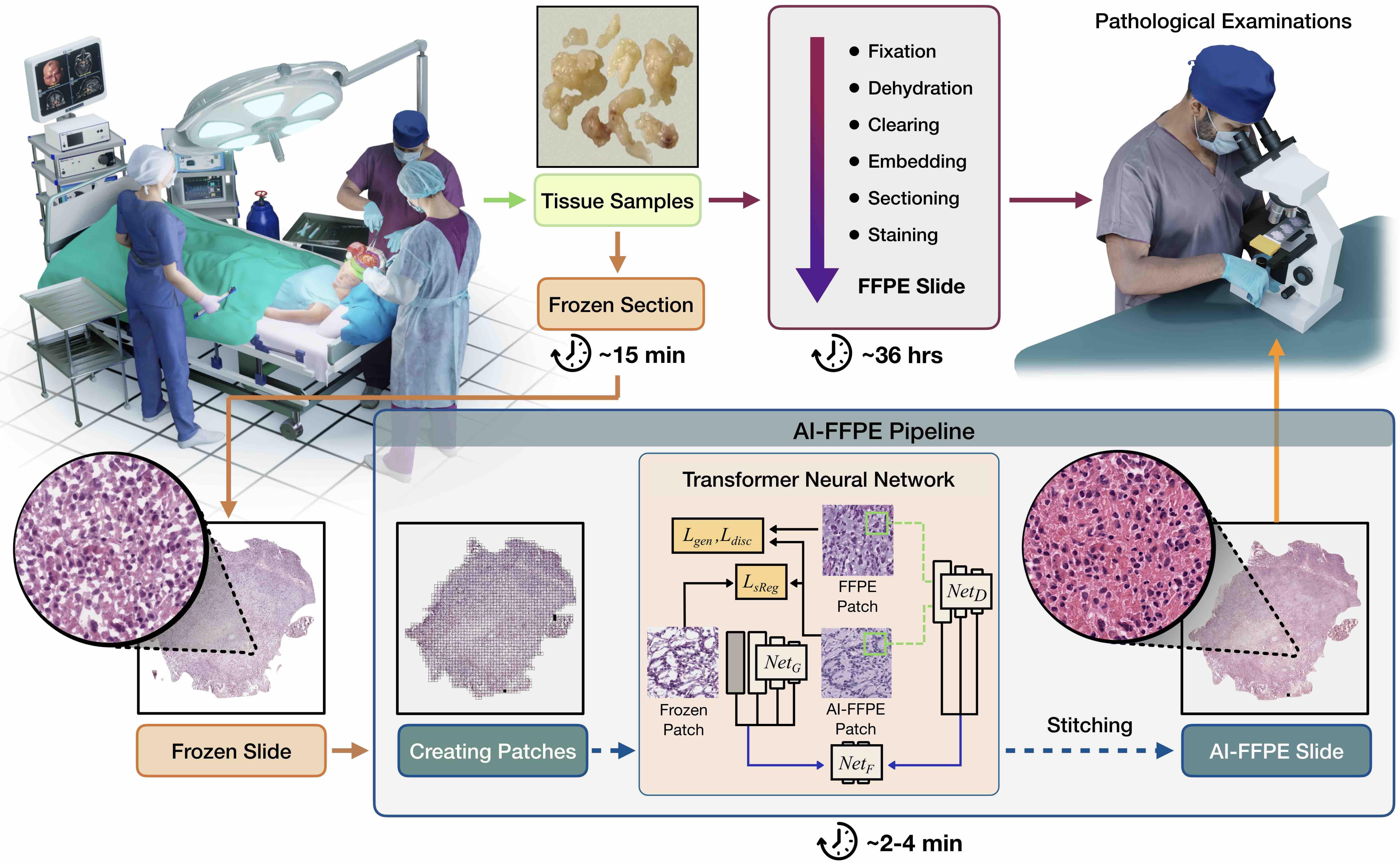 [2107.11786] Deep Learning-based Frozen Section to FFPE Translation