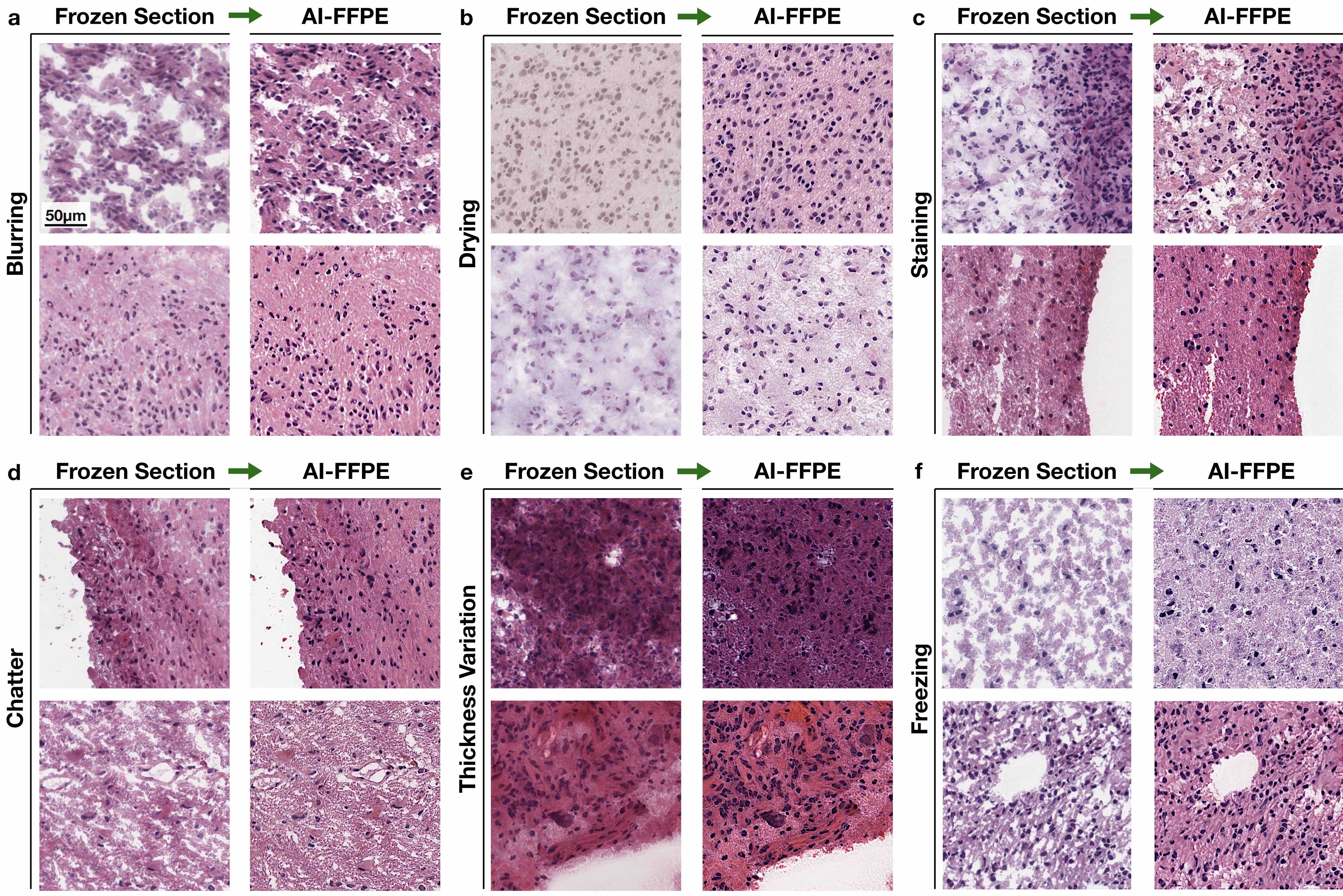 [2107.11786] Deep Learning-based Frozen Section to FFPE Translation