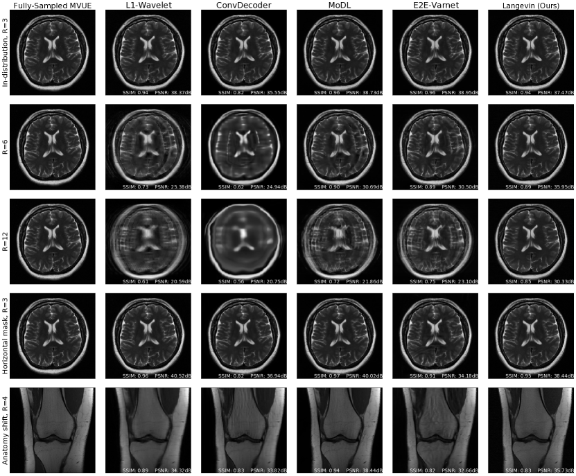 [2108.01368] Robust Compressed Sensing MRI with Deep Generative Priors