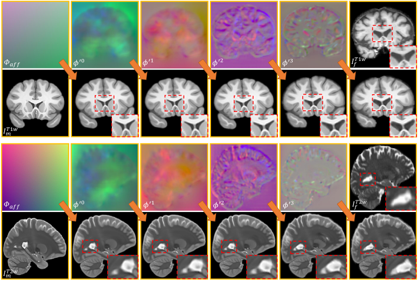 [2109.12384] Joint Progressive and Coarse-to-fine Registration of Brain ...