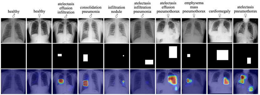 [2109.15222] Natural Synthetic Anomalies for Self-Supervised Anomaly ...
