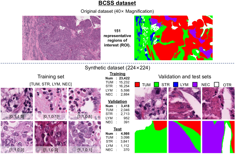[2110.08048] Multi-Layer Pseudo-Supervision for Histopathology Tissue Semantic Segmentation ...