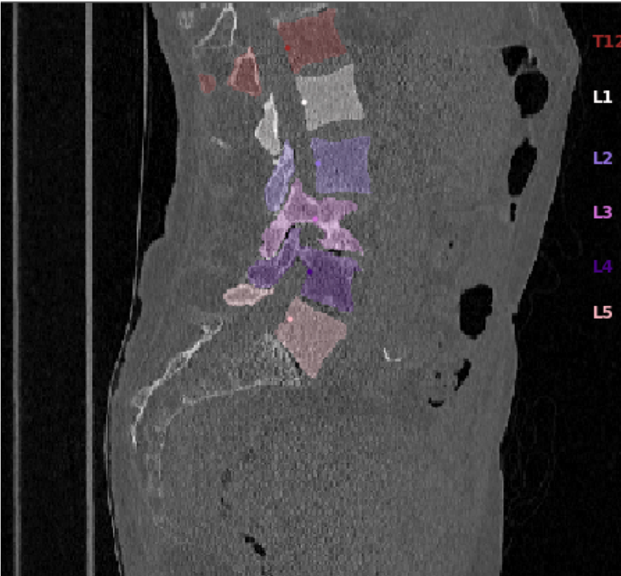 [2110.12177] Vertebrae localization, segmentation and identification using a graph optimization ...