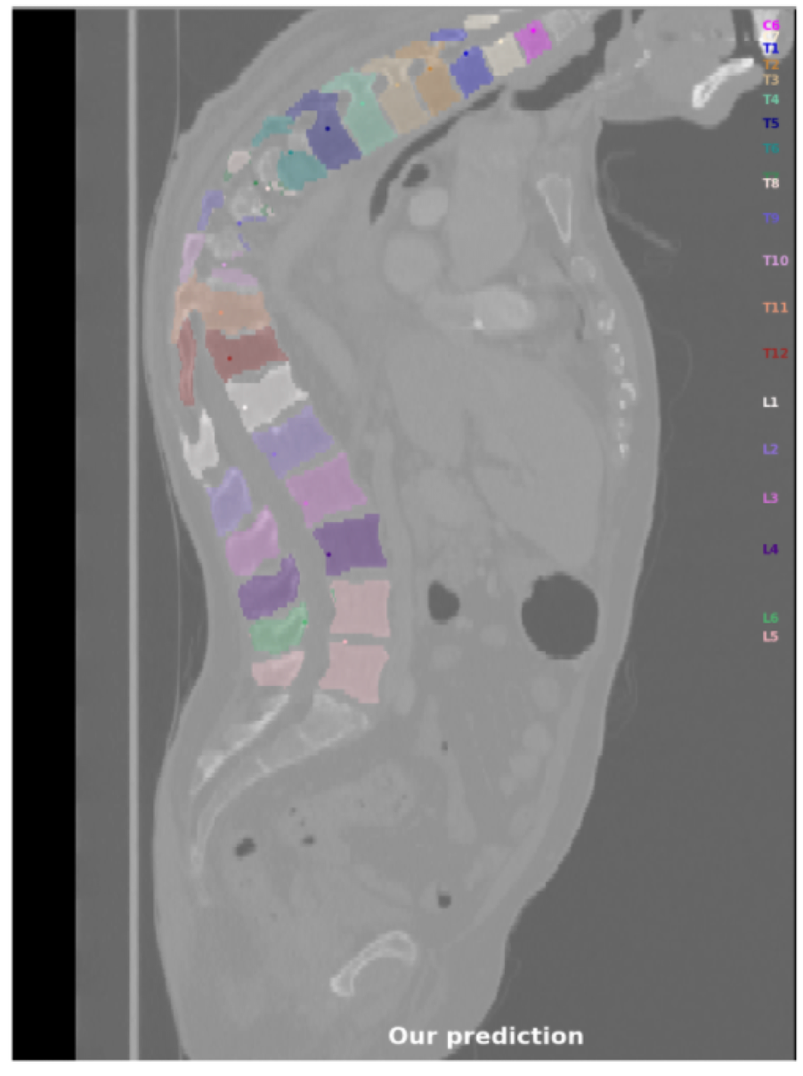 [2110.12177] Vertebrae localization, segmentation and identification using a graph optimization ...