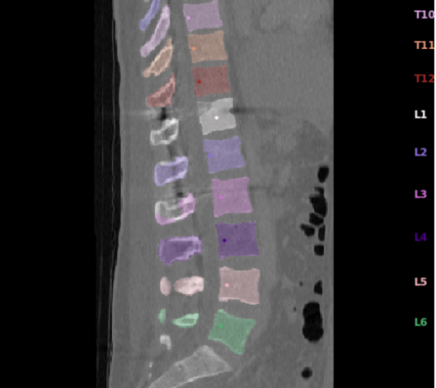 [2110.12177] Vertebrae localization, segmentation and identification using a graph optimization ...