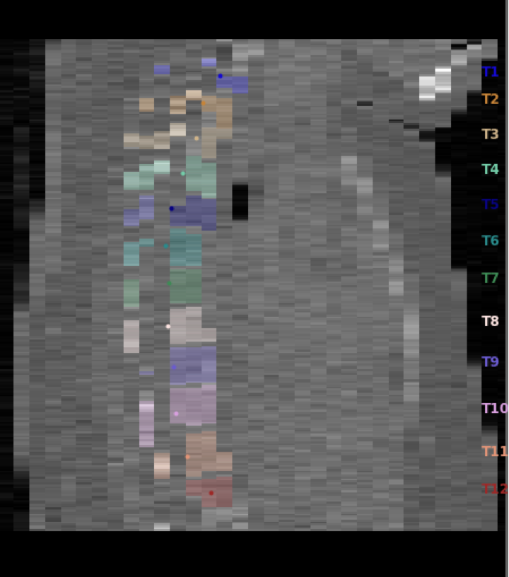 [2110.12177] Vertebrae localization, segmentation and identification using a graph optimization ...