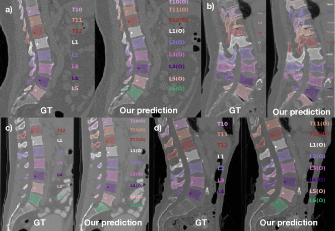 [2110.12177] Vertebrae localization, segmentation and identification using a graph optimization ...