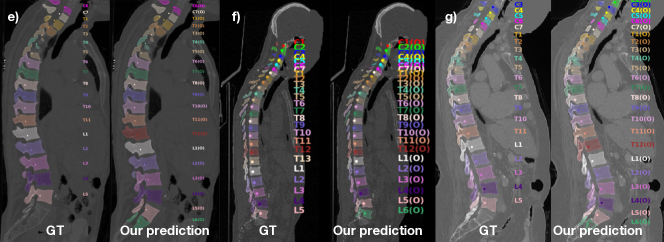 [2110.12177] Vertebrae localization, segmentation and identification using a graph optimization ...