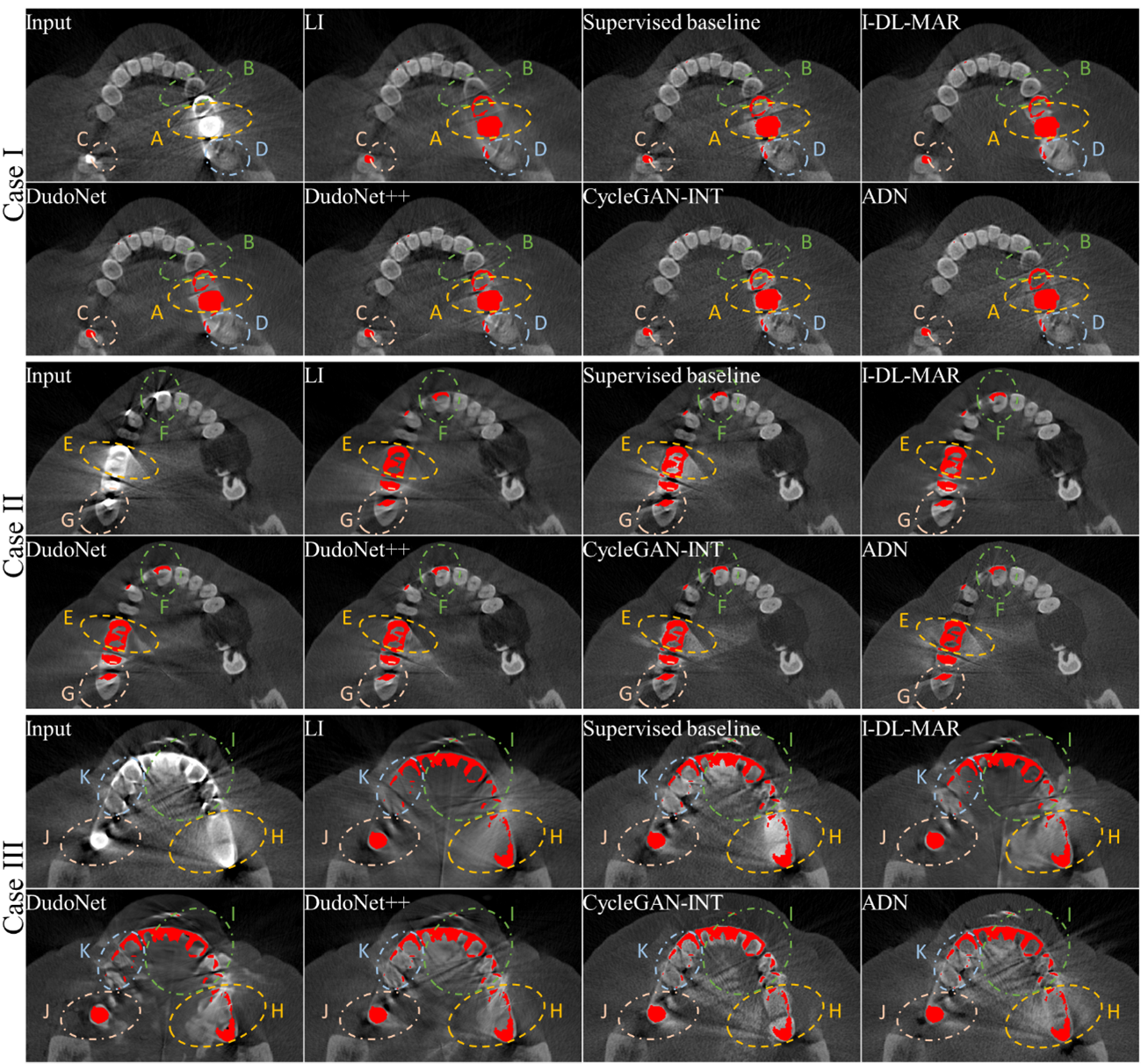 [2111.12983] Investigation of domain gap problem in several deep ...