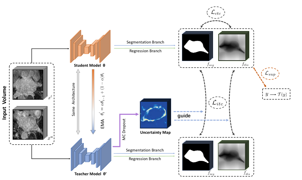 [2112.02508] Uncertainty-Guided Mutual Consistency Learning for Semi-Supervised Medical Image ...