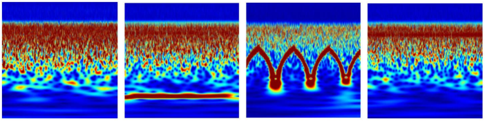 [2112.08988] Interference Suppression Using Deep Learning: Current Approaches and Open Challenges
