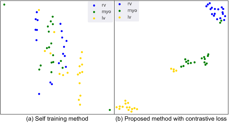 [2112.09645] Local contrastive loss with pseudo-label based self-training for semi-supervised ...