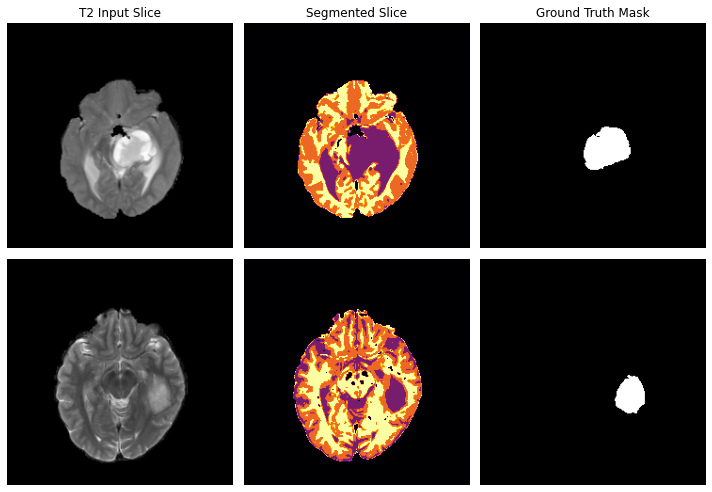 [2201 13271] Strega Unsupervised Anomaly Detection In Brain Mris Using A Compact Context