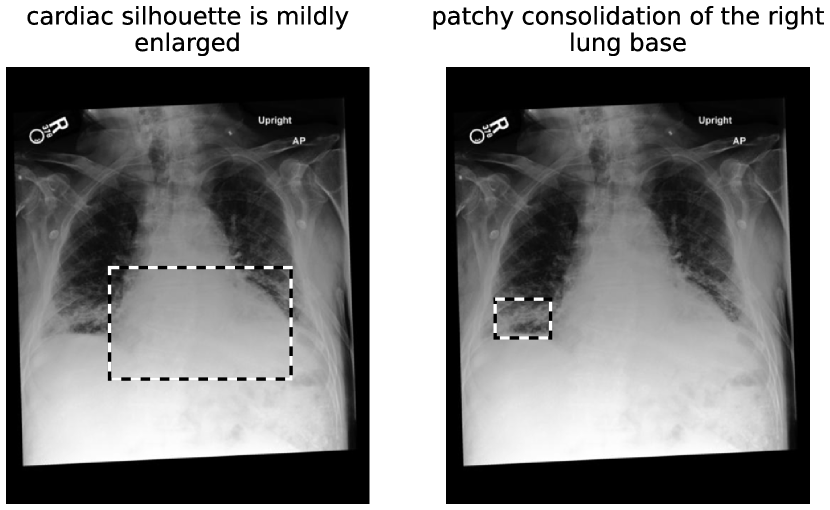 [2204.09817] Making the Most of Text Semantics to Improve Biomedical ...