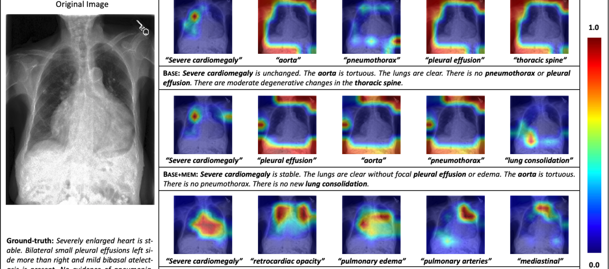 [2204.13258] Cross-modal Memory Networks for Radiology Report Generation
