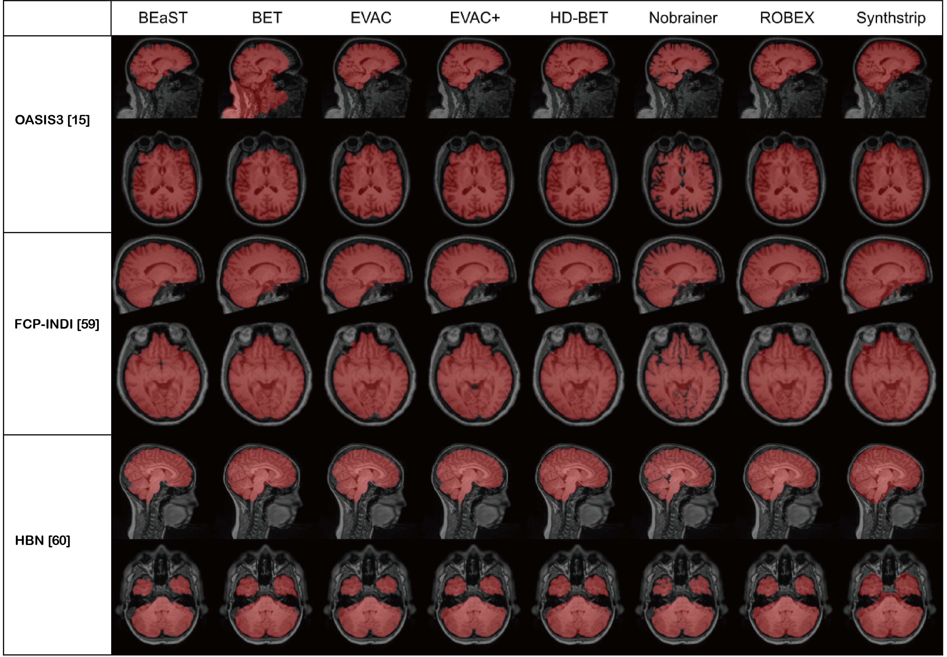 [2206.02837] EVAC+: Multi-scale V-net with Deep Feature CRF Layers for Brain Extraction