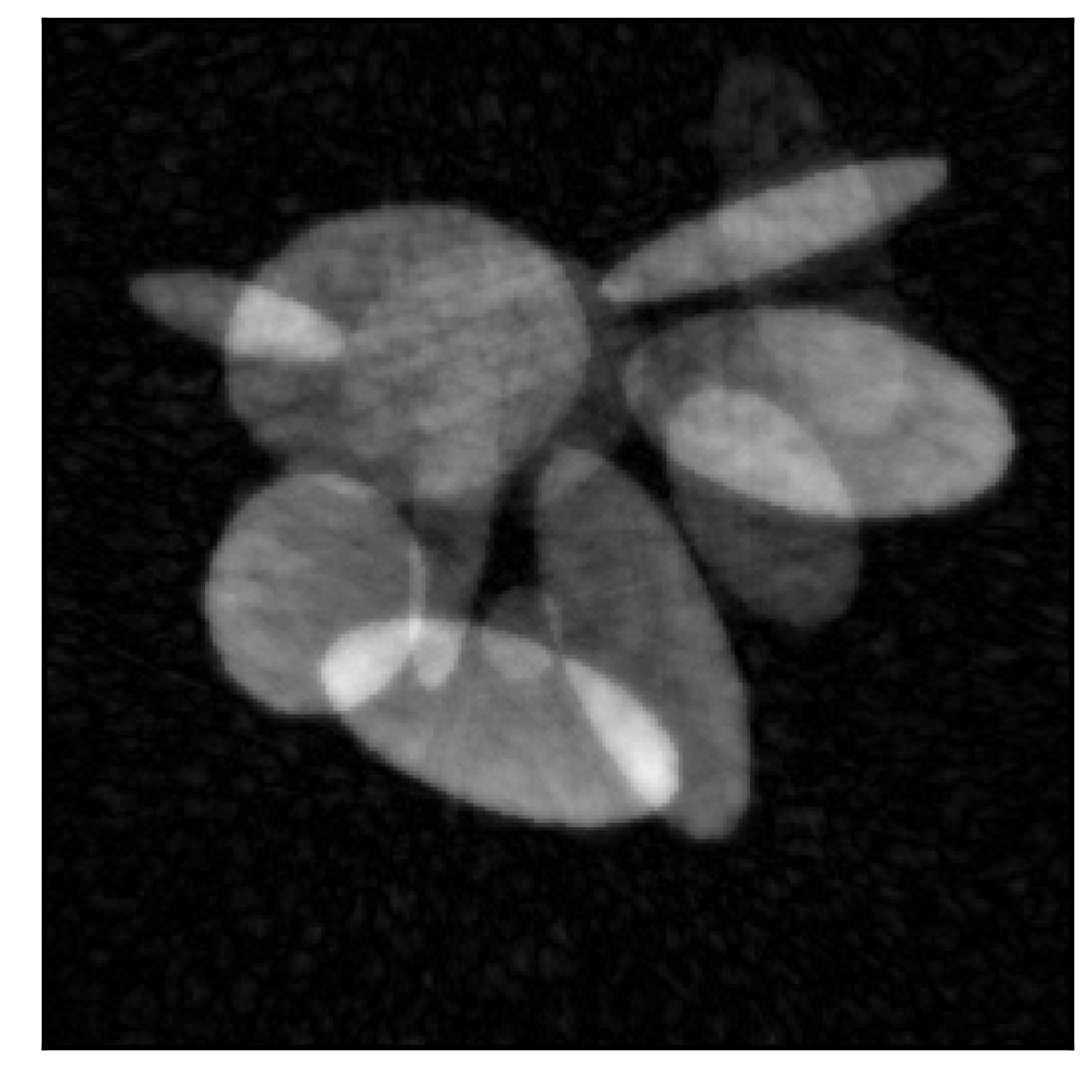[2206.05289] Localized adversarial artifacts for compressed sensing MRI