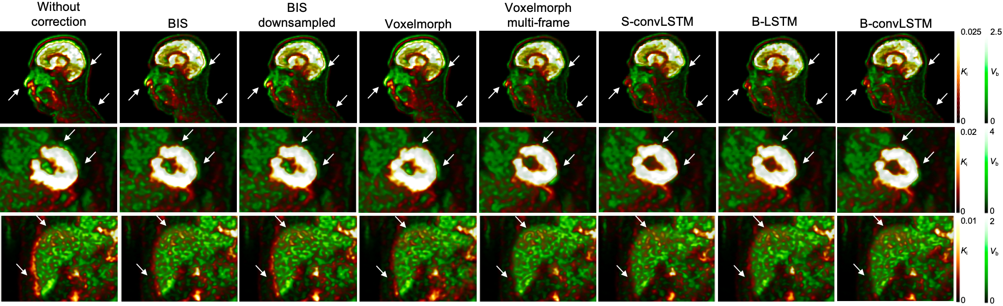 [2206.06341] Unsupervised inter-frame motion correction for whole-body dynamic PET using ...