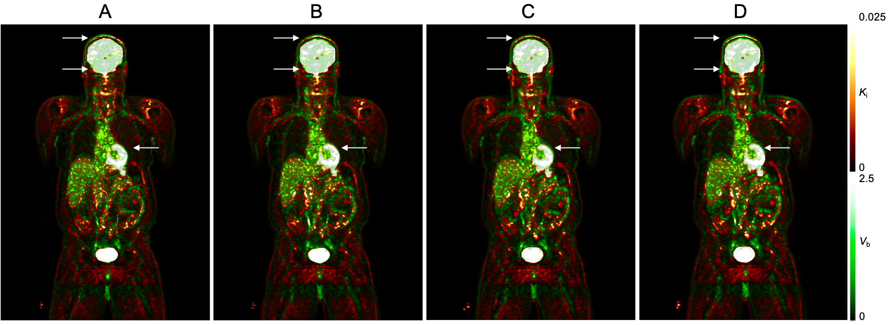 [2206.06341] Unsupervised inter-frame motion correction for whole-body ...