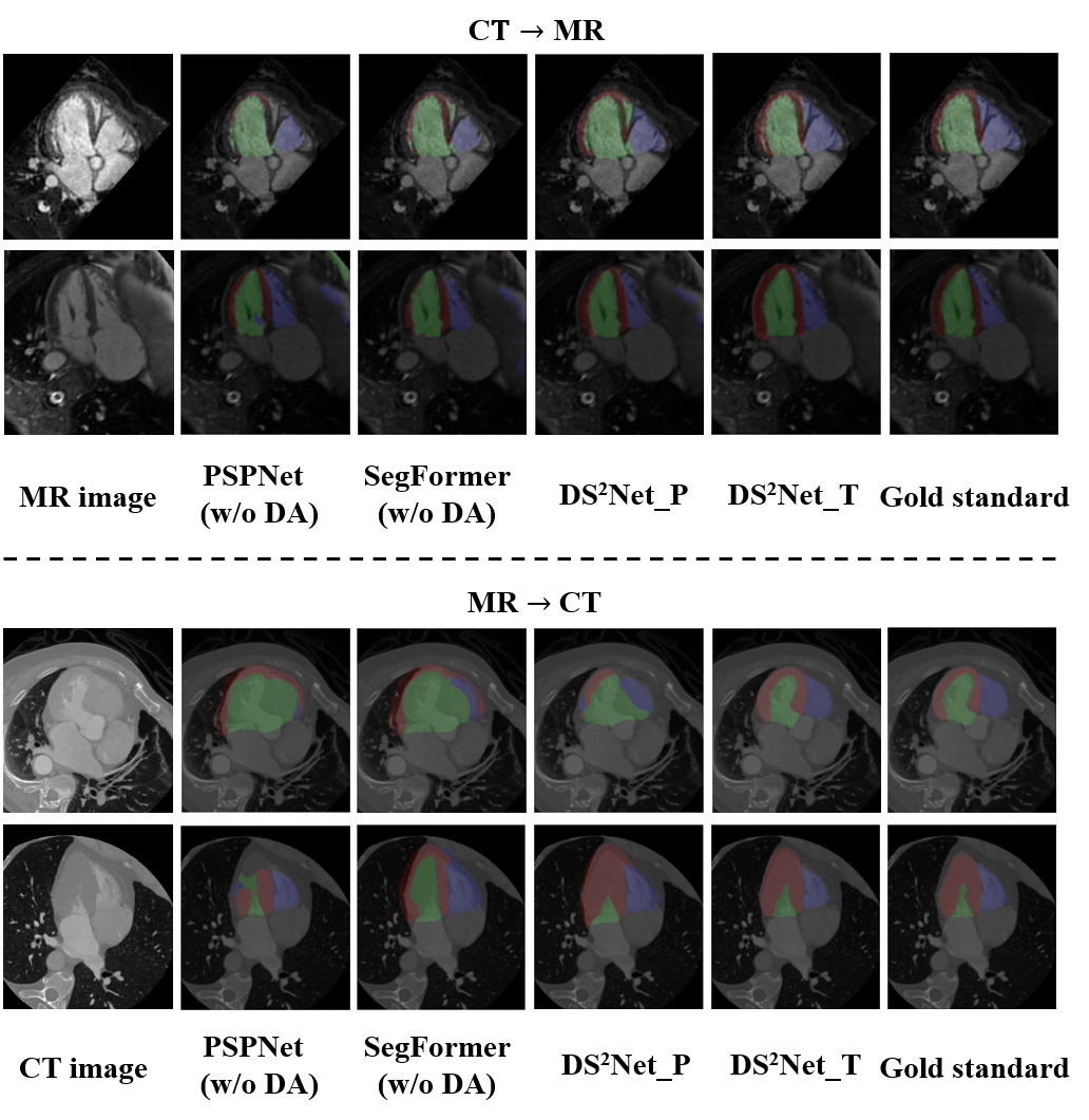 [2207.06799] MMOTU: A Multi-Modality Ovarian Tumor Ultrasound Image ...