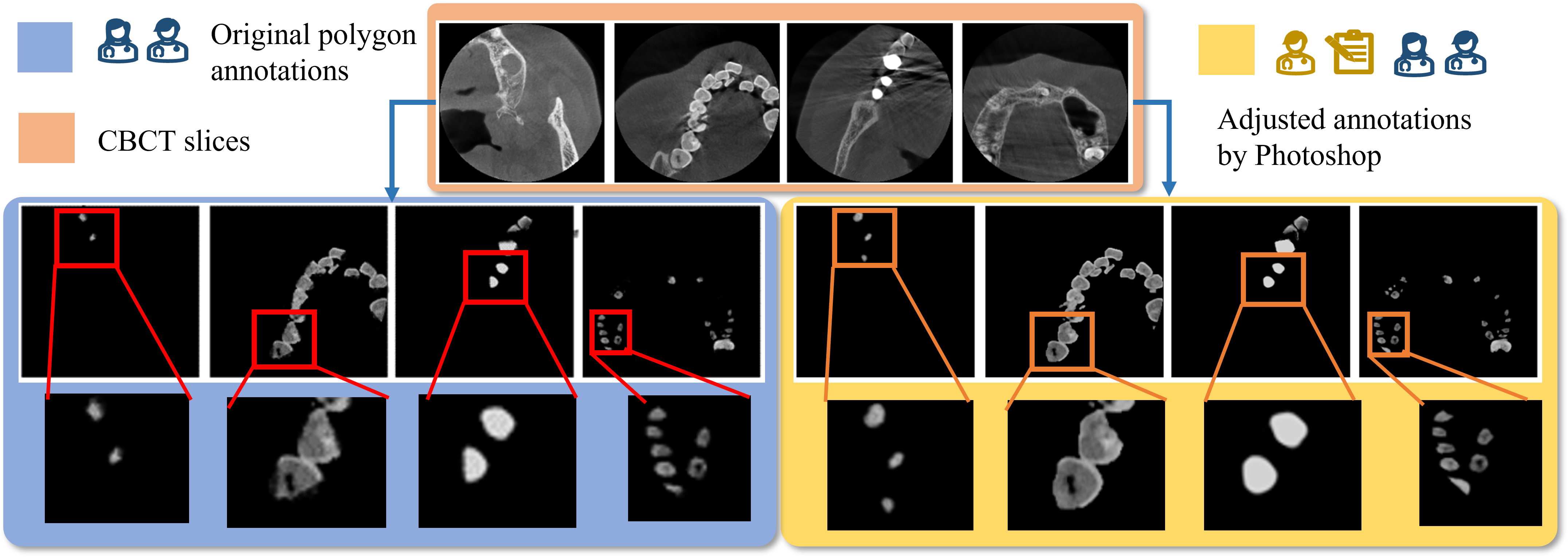 [2208.01643] CTooth+: A Large-scale Dental Cone Beam Computed ...