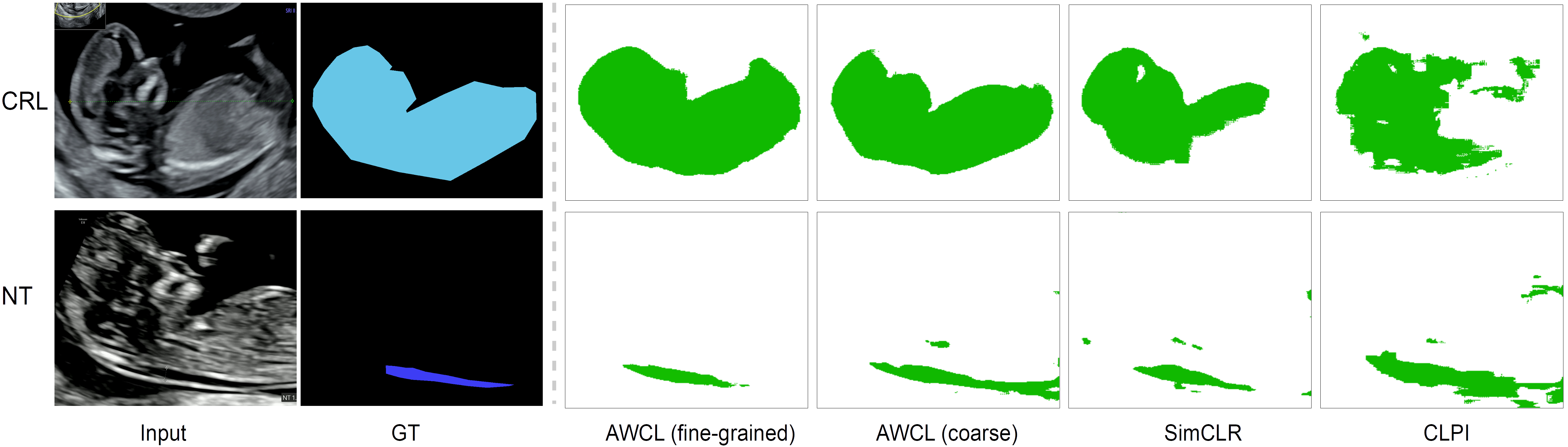 [2208.10642] Anatomy-Aware Contrastive Representation Learning for ...
