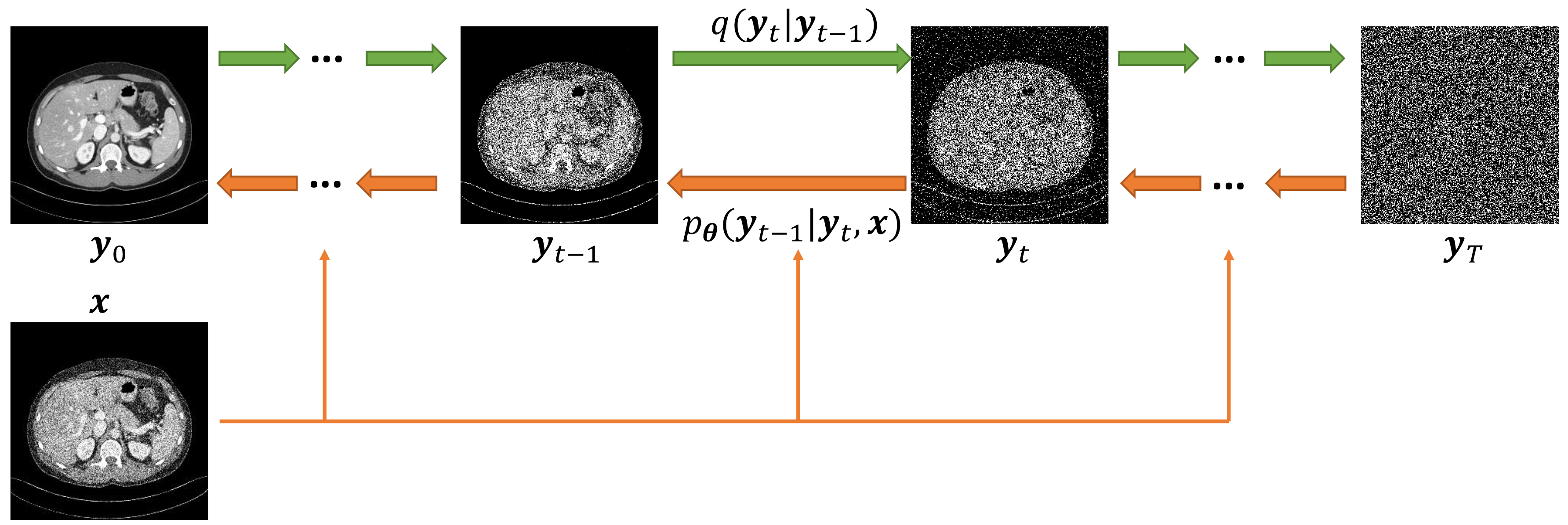 [2209.15136] Low-Dose CT Using Denoising Diffusion Probabilistic Model ...