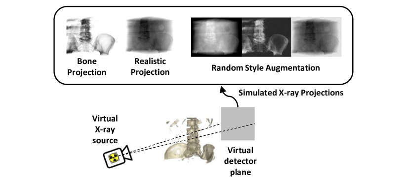 [2210.07611] Self-Supervised 2D/3D Registration for X-Ray to CT Image ...