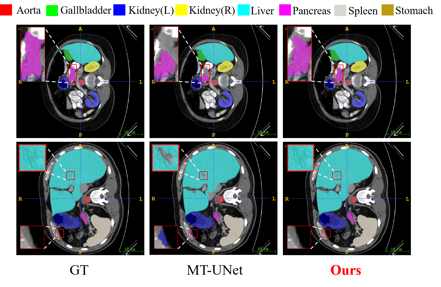 [2210.14007] MEW-UNet: Multi-axis Representation Learning in Frequency ...