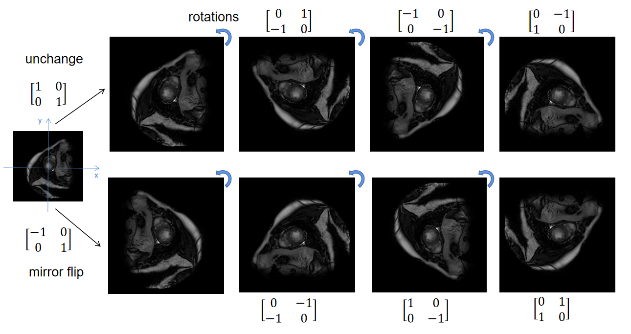 [2211.06641] Prediction of Geometric Transformation on cardiac MRI via ...