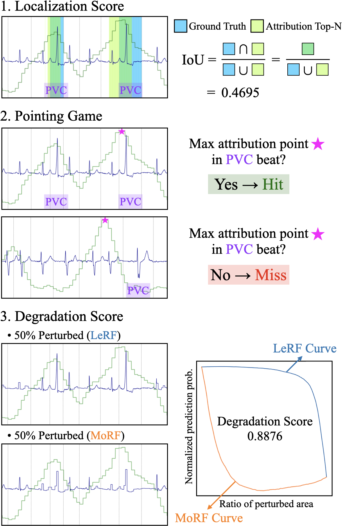 [2211.12702] Evaluating Feature Attribution Methods for Electrocardiogram
