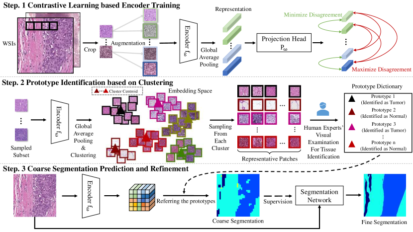 [2211.14491] Human-machine Interactive Tissue Prototype Learning for Label-efficient ...